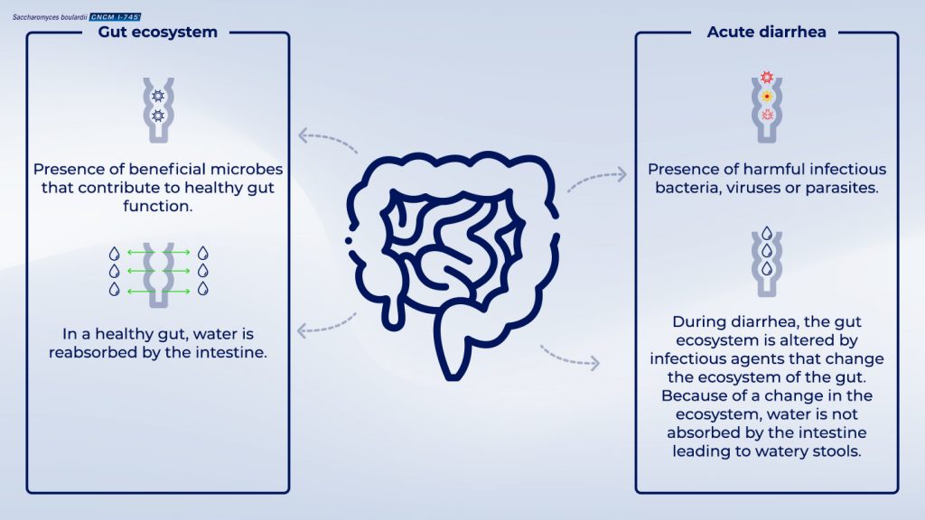 Acute diarrhea – sboulardii – CNCM i-745